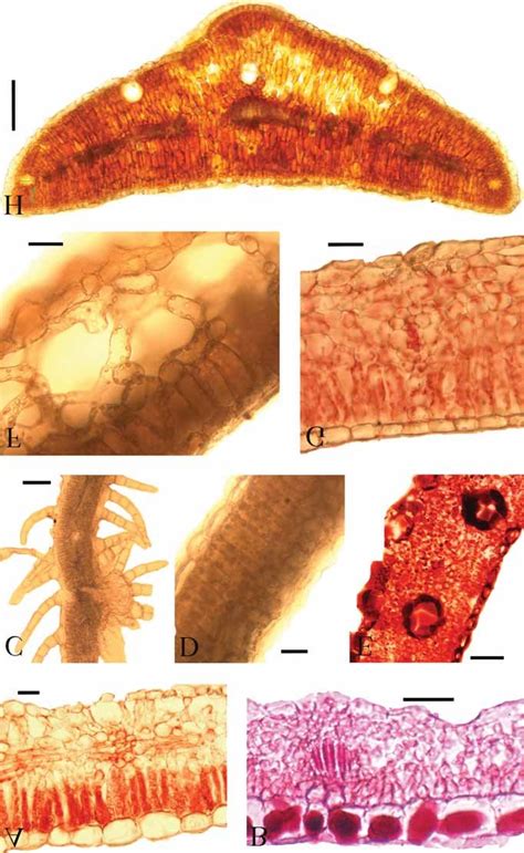 Transversal Sections Of The Leaf Middle Portion H Perforatum
