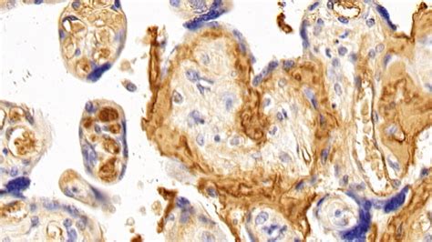 Invitrogen Fibrinogen Polyclonal Antibody Invitrogen 200 μl