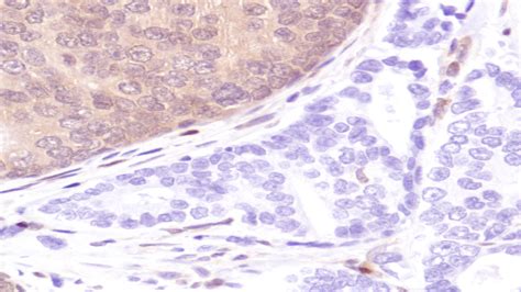 Learn More About The Pten Antibody And Its Uses Technology Genesis