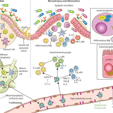 A Comparison Of The Intestinal Immune System In Both Healthy State And