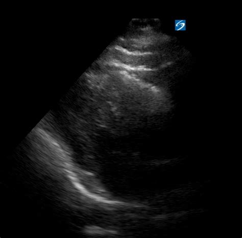 Plax Hyperdynamic On Vimeo