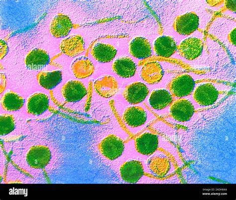 False Colour Transmission Electron Micrograph Tem Of Lambda Bacteriophages Phages A Type Of