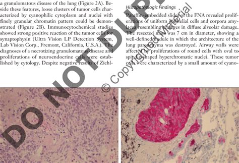 Paraffin Embedded Sections Of Formalin Fixed Tissue Blocks Of The