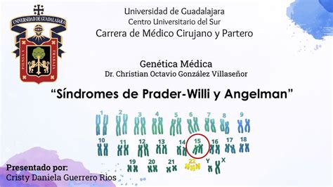 Síndrome Prader Willi Y Angelman Cristy Daniela Guerrero Rios Udocz