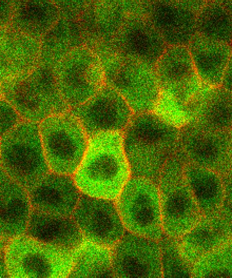 image analysis with fiji how can i extract the green signal which