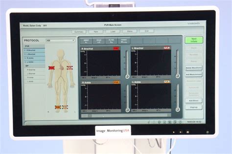 Used Corvascular Abi Doppler Waveform Analyzer For Sale Dotmed