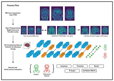 Detection Of Parkinsons Disease From 3t T1 Weighted Mri Scans Using 3d