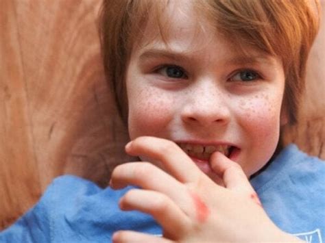 Stimming Selvstimulerende Adfærd I Autisme