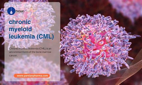 Chronic Myeloid Leukemia Cml Parsian Pharmaceutical Co
