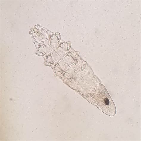 Demodex Skin Mite Parasite Rparasitology