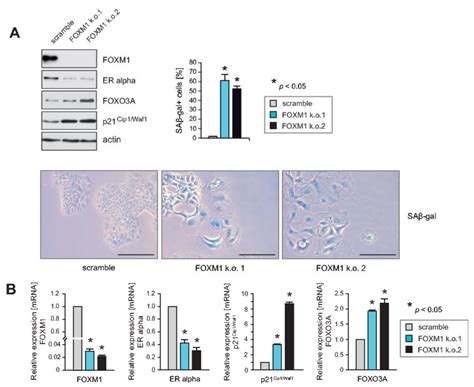 Knockdown Of Foxm1 Inhibits Expression Of Erα And Induces Cell Cycle