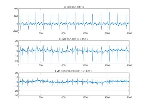 课程设计项目23：孕妇心电图中胎儿心电信号的提取孕妇心电图提取 Csdn博客