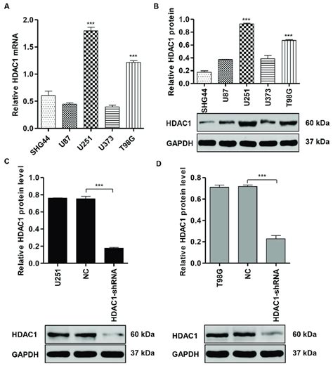 Hdac1 Expression In Glioma Cell Lines Ab Hdac1 Expression Levels In