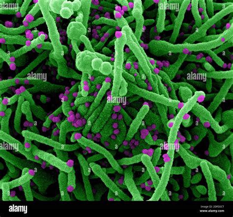 Colorized Scanning Electron Micrograph Of A Cell Green Infected With