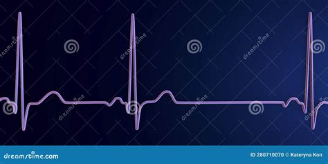 Electrocardiogram Ecg Displaying Sinus Arrhythmia 3d Illustration