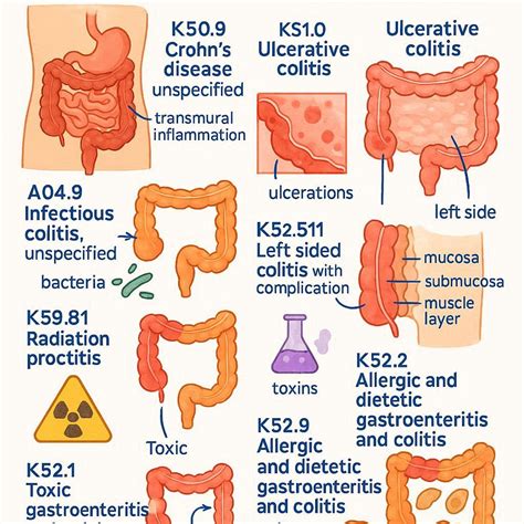 A Comprehensive Guide To Icd 10 Codes For Colitis Wmwtl