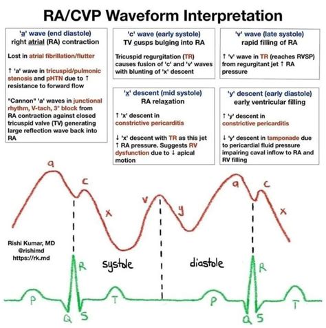 Ra Waveform Medizzy