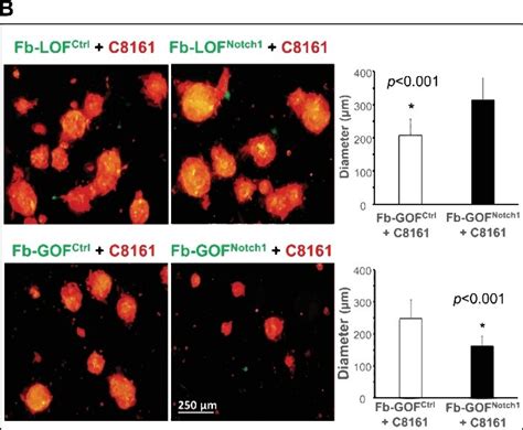 Elucidation Of Role Of Intracellular Notch1 Signaling Pathway Activity Download Scientific