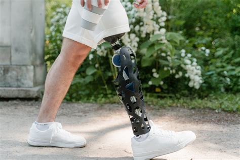 Transtibial Vs Transfemoral Prosthetics Which One Is Right For You