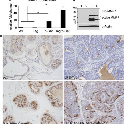 Expression Of Nuclear β Catenin Increases Mmp7 Level A Mmp7 Mrna