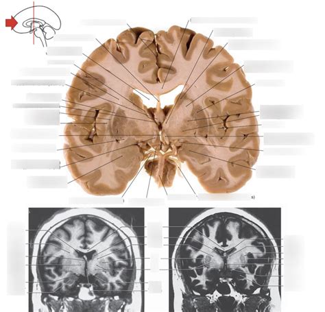 Brain Slice 2 Diagram Quizlet