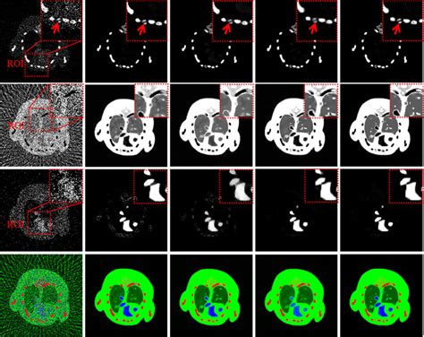 Material Decomposition Results Of Images Reconstructed By Different