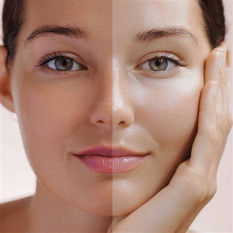 7 Amazing Skin Benefits Of Turmeric You Should Know