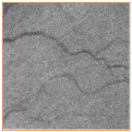Pdf Fundus Image Denoising Using Fpga Hardware Architecture
