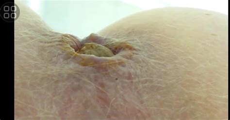 Close Up Pooping Compilation