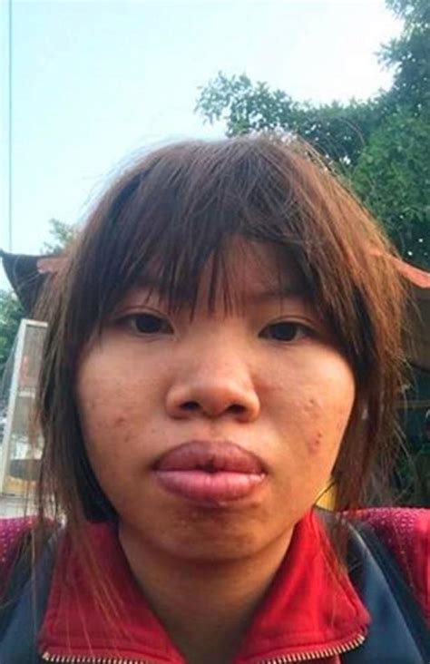 泰國女子面部醜陋堪比鳳姐，被男友拋棄後去整容，竟走上人生巔峰 每日頭條