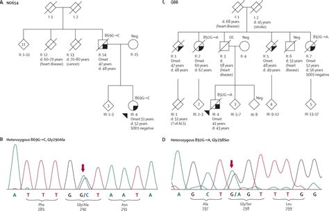 TARDBP Mutations In Amyotrophic Lateral Sclerosis With TDP 43