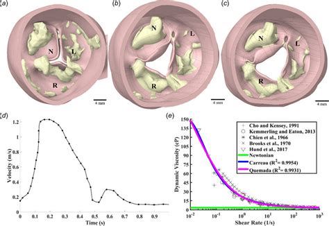 Cfd Model Preparation A Diastolic Configuration With A Tri Leaflet