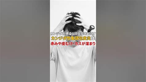 亀頭包皮炎とは？原因、症状、検査、治療法、注意点などを解説 Shorts 亀頭包皮炎 Youtube