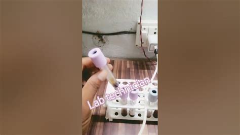 Lab 💉🧫🧪 Youtube