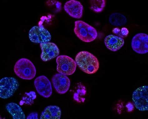 Analyzing Single Cell Data Scanpy Joy Mcilvaine Phd