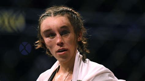 Joanna Jedrzejczyk Shows Off Healing Forehead After Suffering Horror