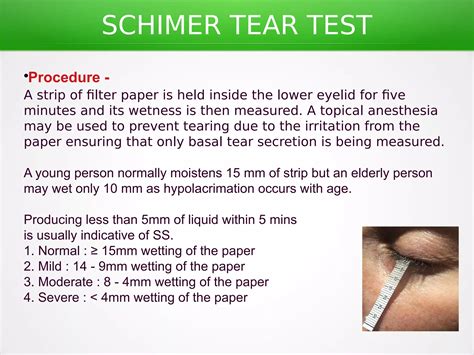 Sjogrens Syndrome Pdf