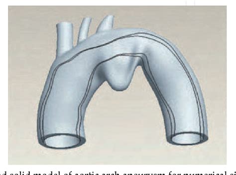 Figure 4 From Numerical Simulation In Aortic Arch Aneurysm Semantic