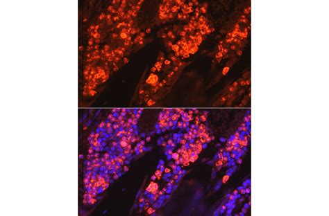 Anti Myeloperoxidase Antibody A13440