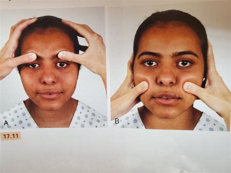 Assessing Mouth Throat Nose Sinuses Flashcards Quizlet