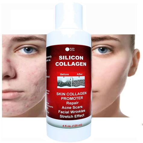Skin Scars Silicon And Collagen Hydrolyzed Gel Resurfacing Skin Collagen Promoter
