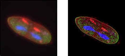 Main Differences Between Confocal And Widefield Microscopy