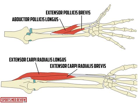 Intersection Syndrome A Review Sports Medicine Review