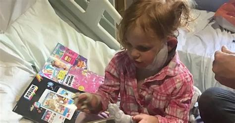 Horrific Moment Girl Four Suffers Serious Burns And Is Scarred For