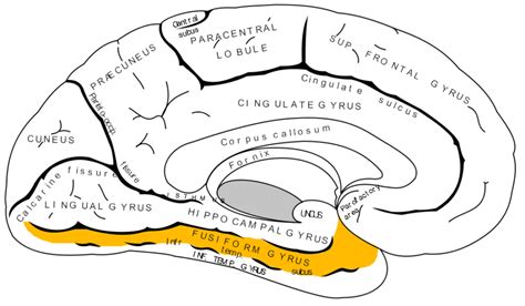 Fusiformgyrus 1 Neurofm