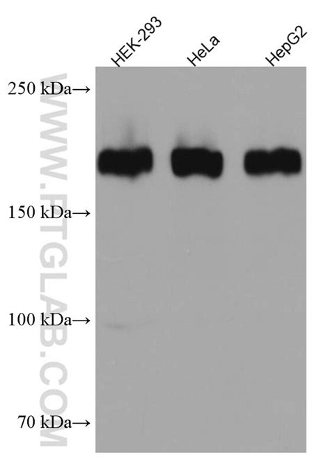 Zeb1 Antibody 66279 1 Ig Proteintech