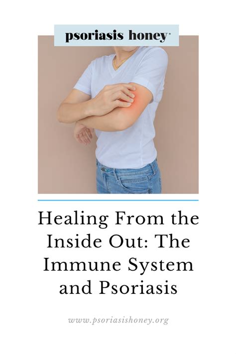 As With Other Chronic Skin Diseases Living With Psoriasis Is A