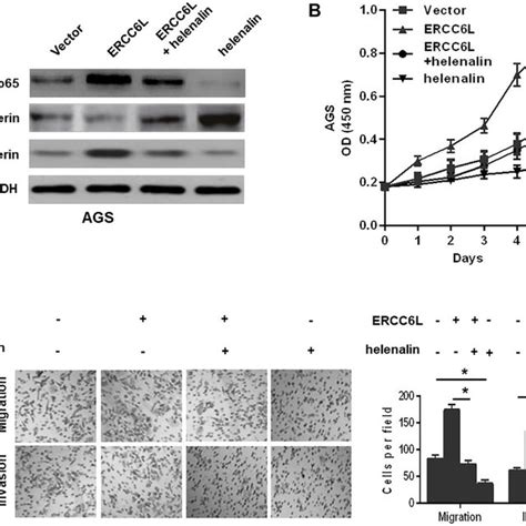 Nf κb Signal Involved In Ercc6l Facilitated Gc Cell Emt Growth