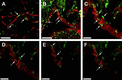 HSC Derived EGFP D Cells Within The Tumor Stroma Are Perivascular