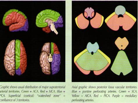Brain Vascular Anatomy With Mra And Mri Correlation Ppt